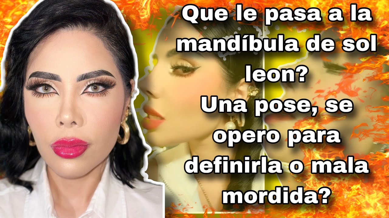 Qué le pasó a Sol León en su mandíbula?/Georgette Rocha - YouTube