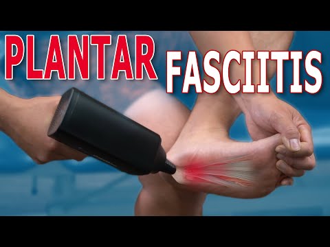 Relieve Plantar Fasciitis With A Massage Gun | Physical Therapist Explains How