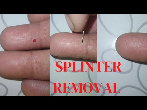 Splinter removal brass metal. @BewithUmer - YouTube