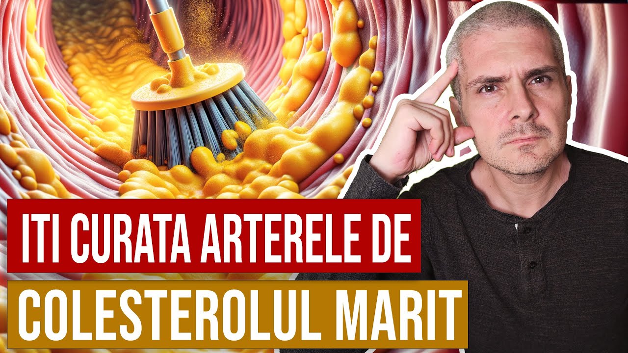 Cum scazi un colesterol marit. Metode naturale eficiente. - YouTube