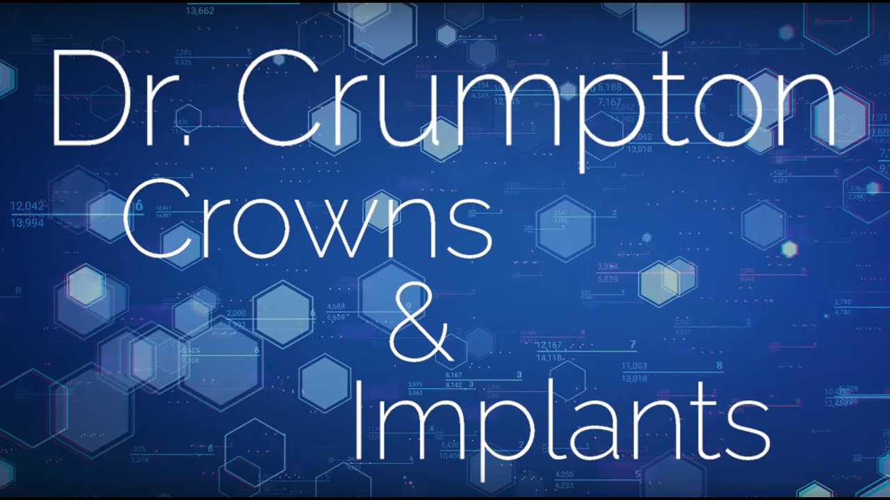 Dr. Crumpton Answers Your Questions About Dental Crowns and Implants ...