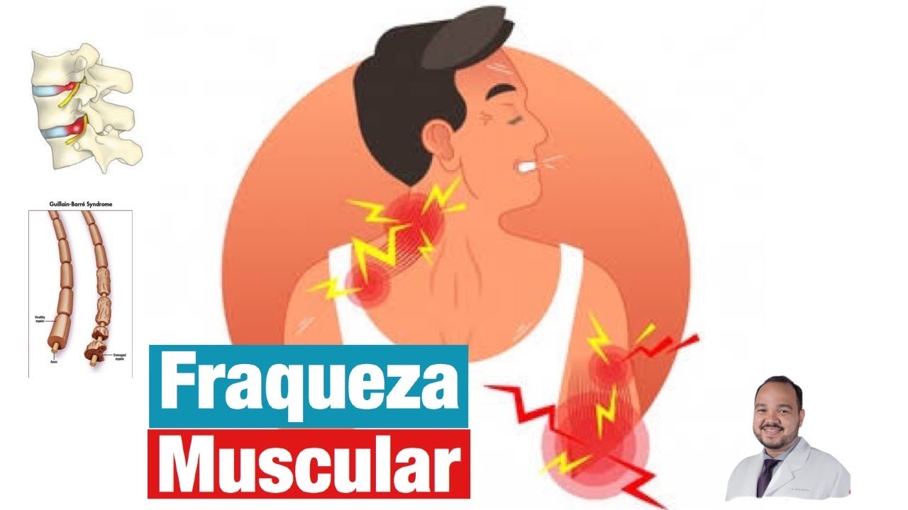 Fraqueza Muscular Crônica: O que pode causar ? - YouTube