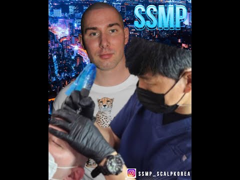 BALD Man gets SMP in South Korea