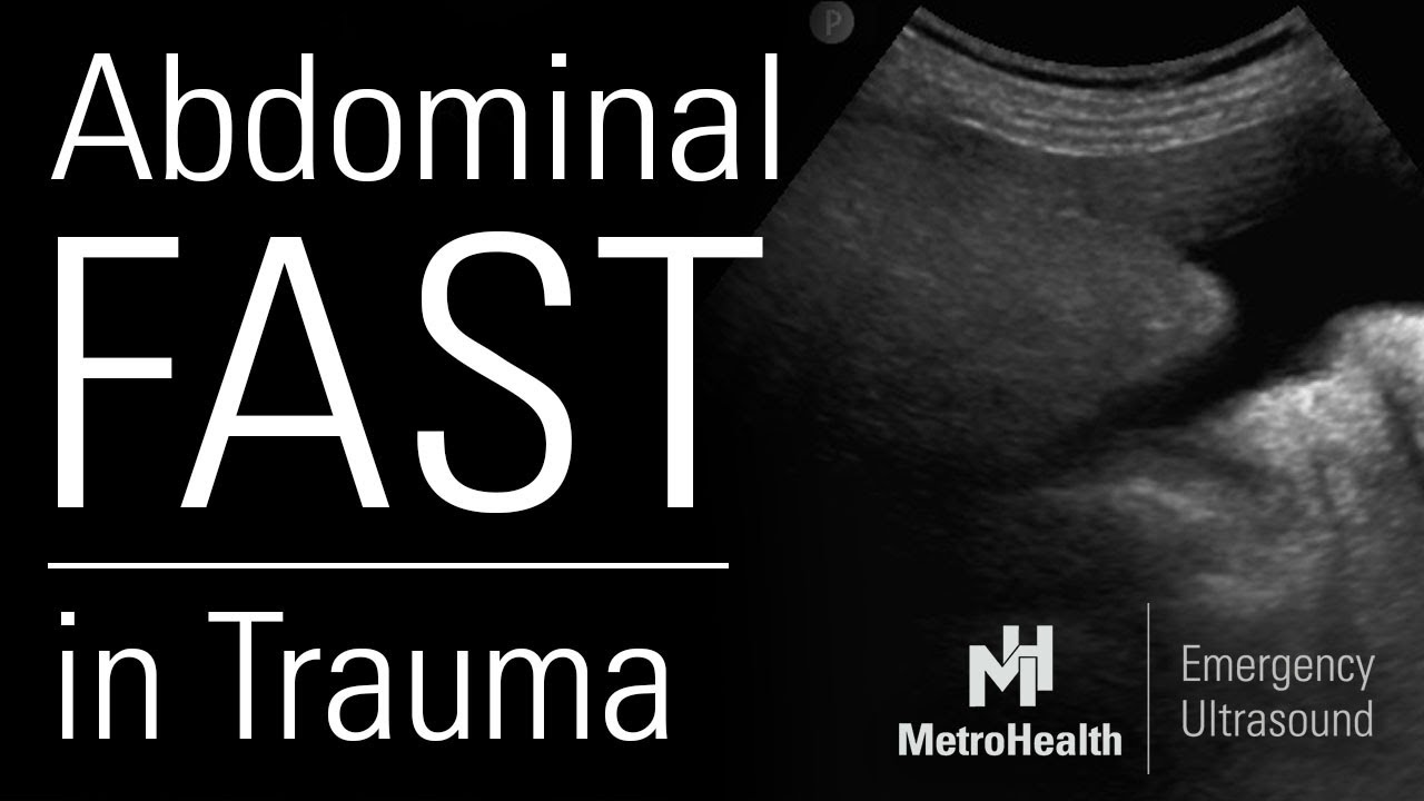 The Abdominal FAST - YouTube