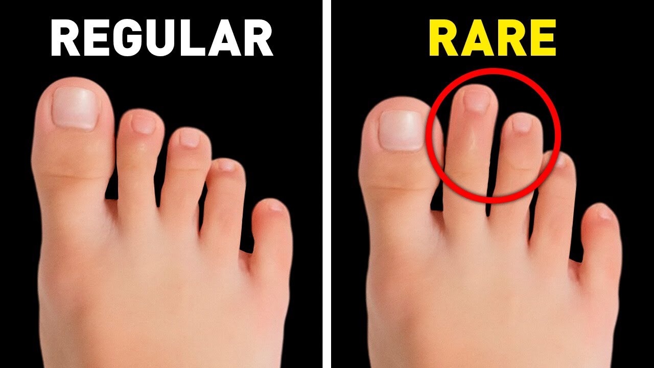 Your Feet Will Reveal How Rare Your Body Is - YouTube
