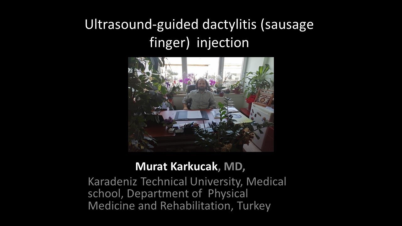 Ultrasound-guided dactylitis (sausage finger) injection, by Prof Murat ...
