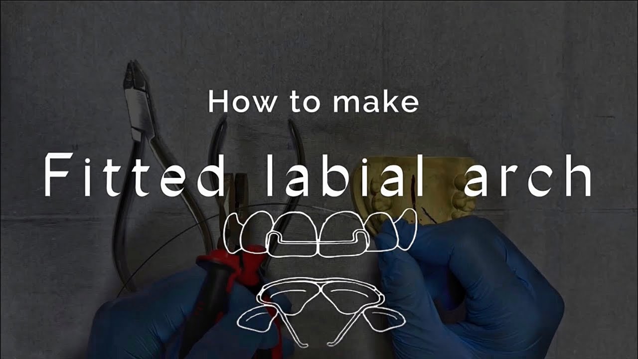 How to make Fitted labial arch ? - YouTube