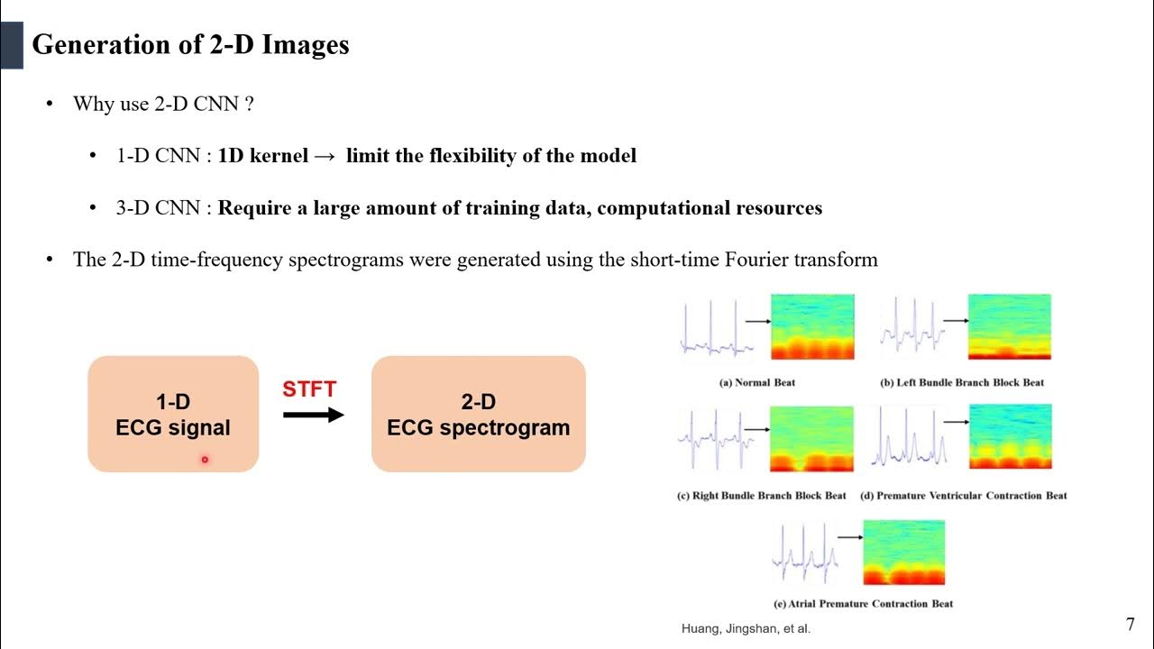 [저널미팅]Classification of Arrhythmia by Using Deep Learning with 2-D ECG ...