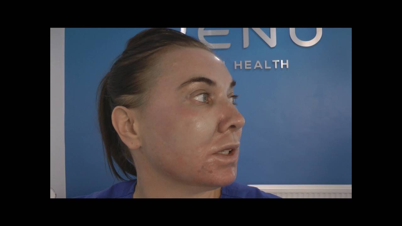 Controlled depth peel day 1 - YouTube