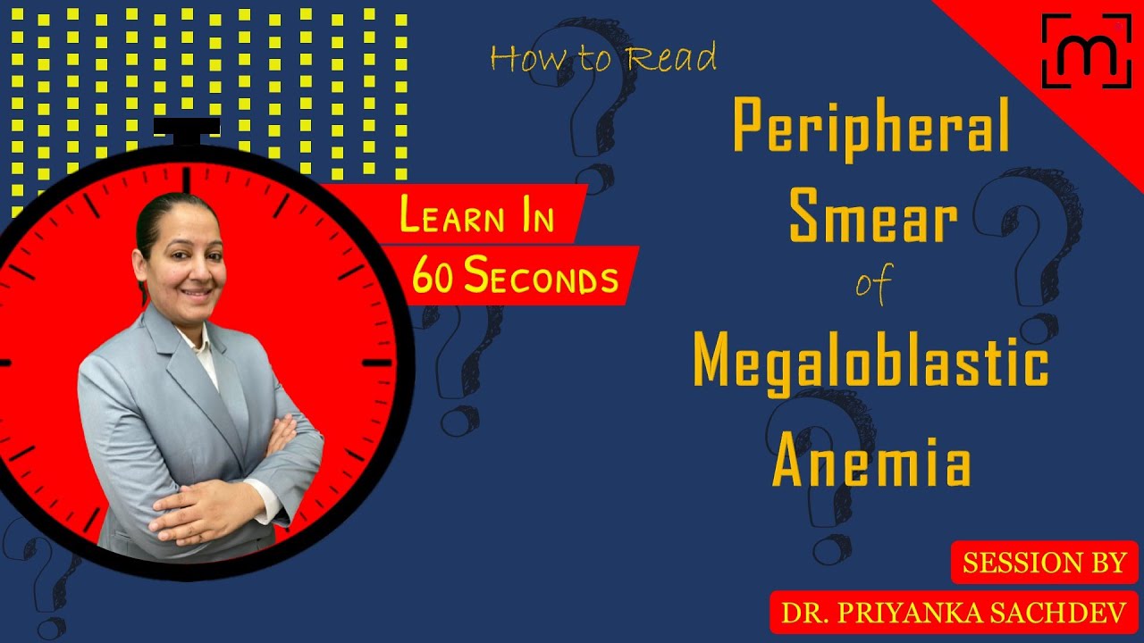 1 minute learning: Peripheral Smear of Megaloblastic Anemia | Dr ...
