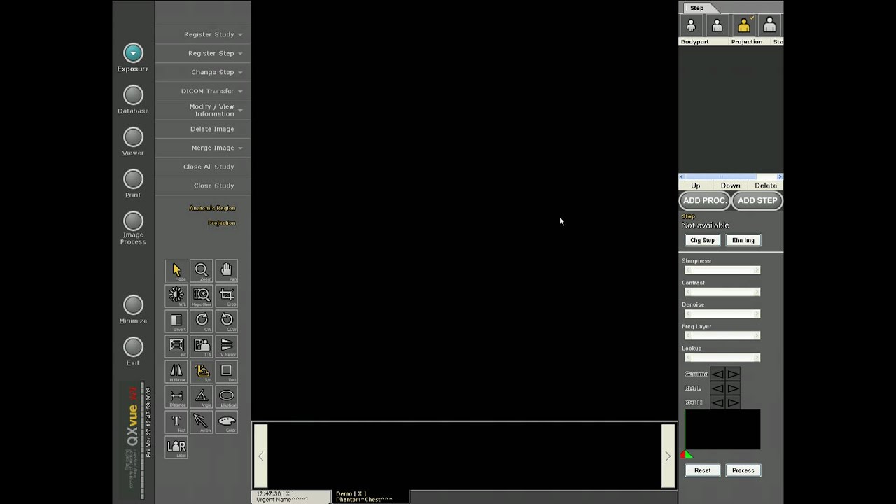 QXVue Exposure - YouTube