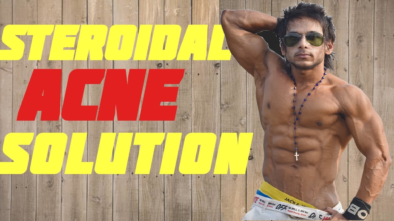 ONLY MED 💊 FOR STEROIDAL ACNE | NO BS | - YouTube