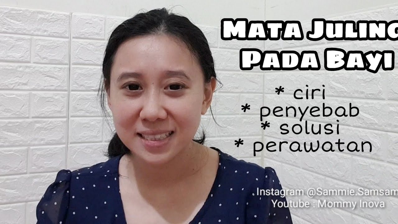 Bayi Juling Penyebab Ciri dan Rawatan Bayi Bermata Juling l Strabismus ...