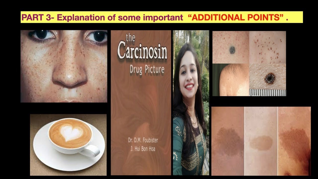 Homeopathic Drug Carcinosin (Part 3) - "SPECIAL ADDITION" for ...