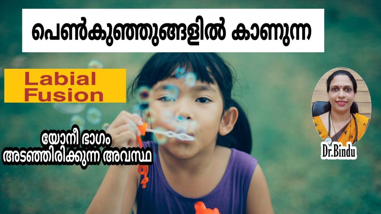 Labial fusion in children/ യോനീഭാഗം അടഞ്ഞിരിക്കുന്ന അവസ്ഥ - YouTube
