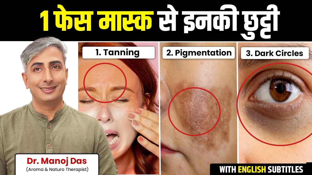 Pigmentation, Dark Spot, Tanning- इस Remedy से होगा 100% इलाज | Dr ...