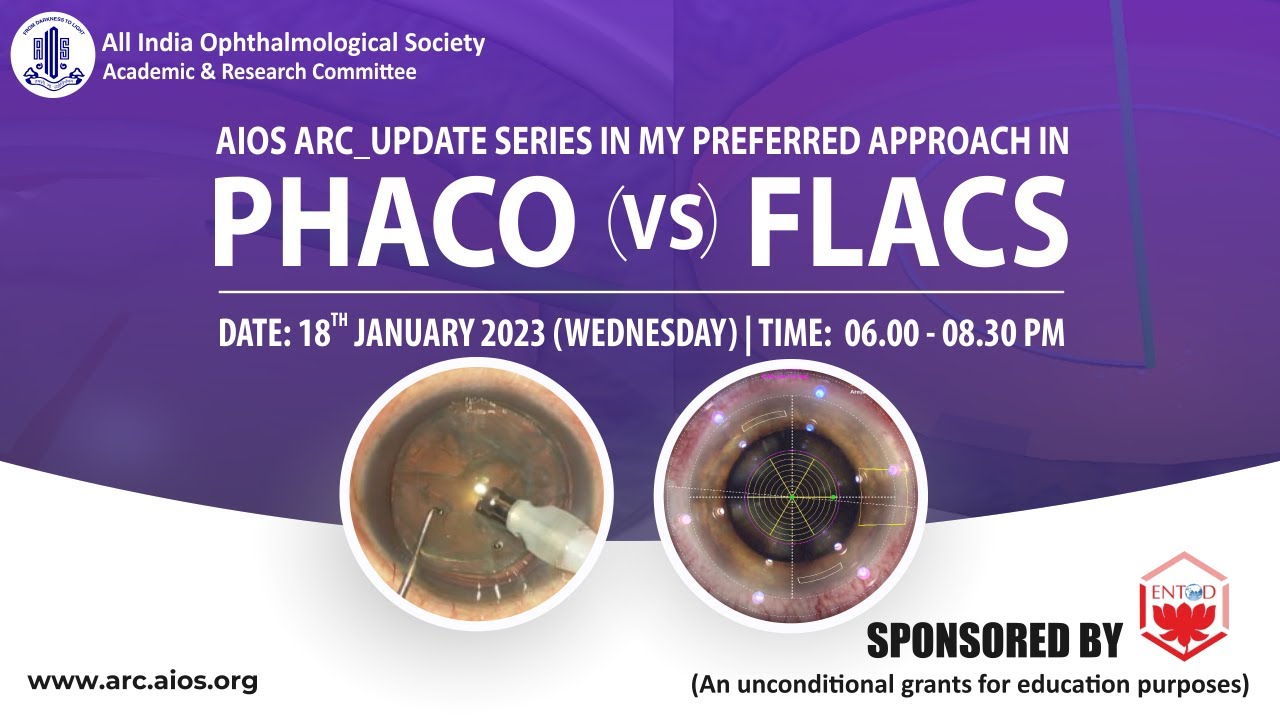 Update series on My preferred approach in Phaco & Flacs - YouTube