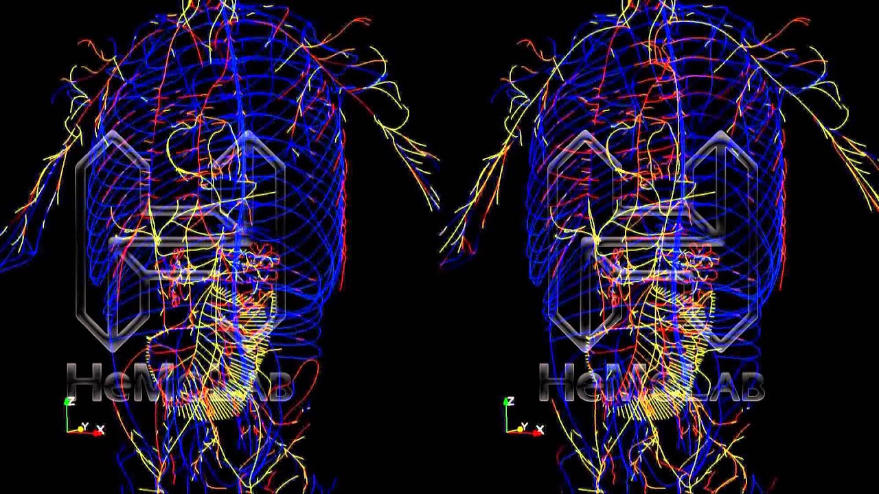 Arterial blood flow - ADAN model (aortic coarctation) - YouTube