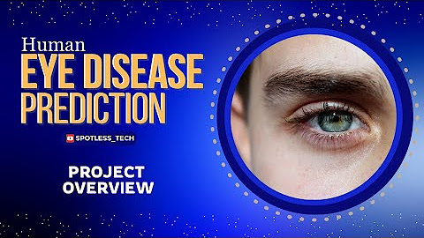 Human Eye Disease Prediction System | Building Image Recognition Model ...