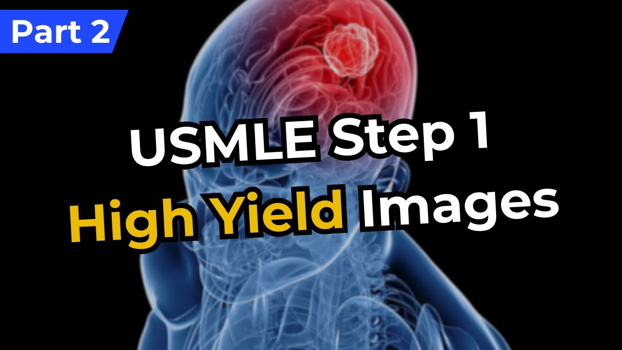 USMLE Step 1 High Yield Images (Part 2) - YouTube
