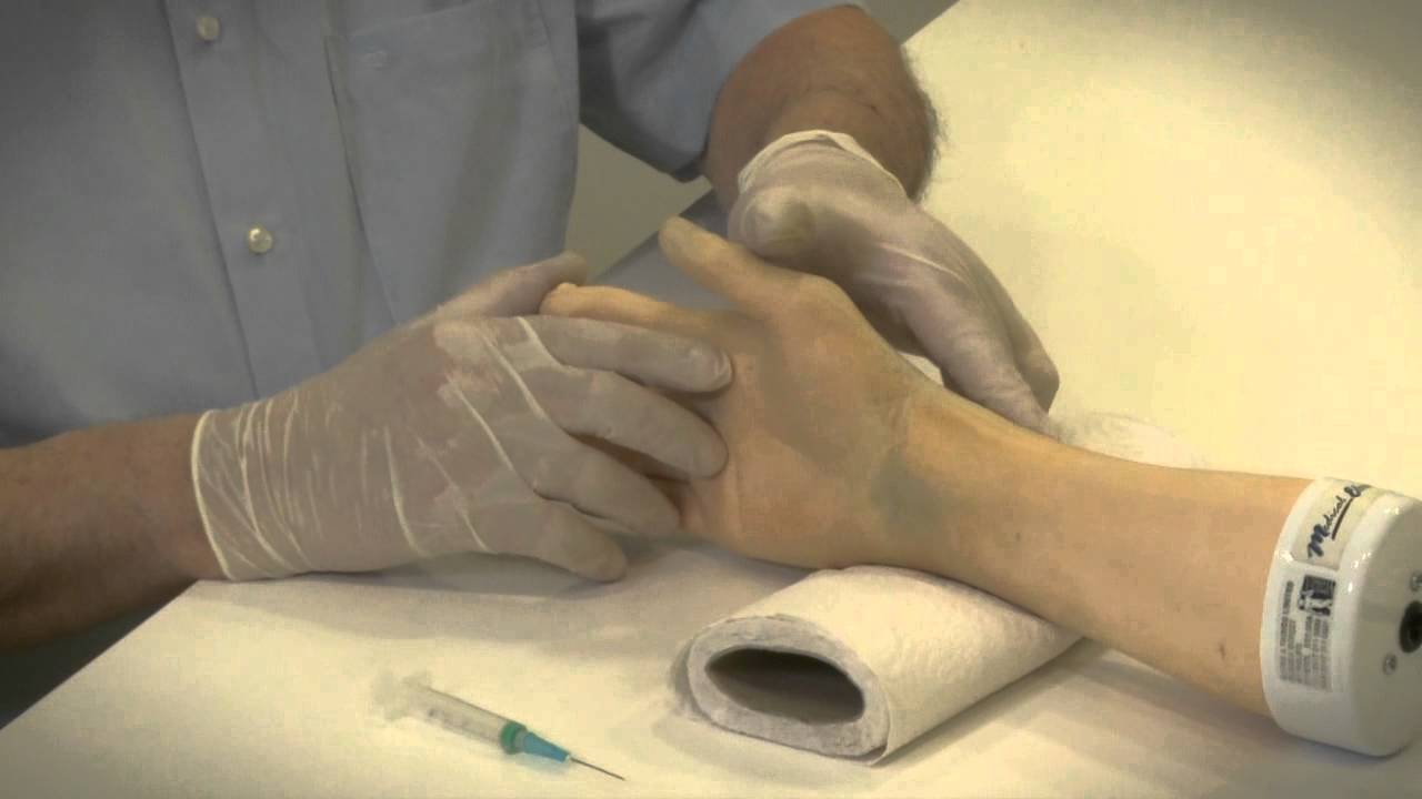 403 Infiltratie Hand - YouTube