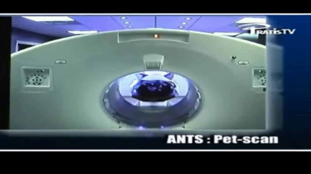 TEP Scanner Petscan - YouTube