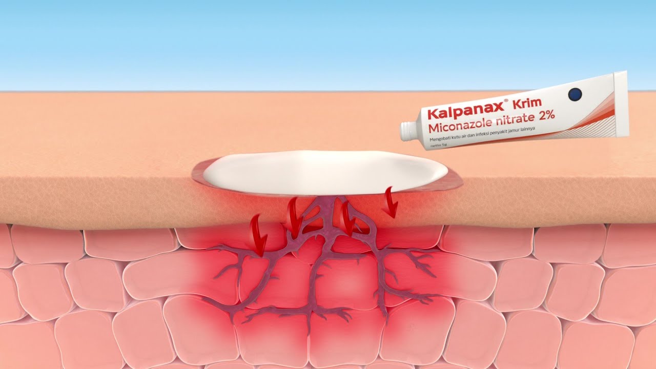 Kalpanax Krim Tuntas Tas Tas - YouTube