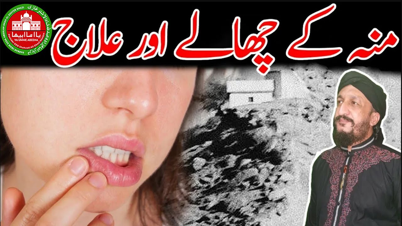 Munh Kay Chalay|منہ چھالےعلاج|मुंह छाले उपचार|Tip|Totkey|Desi|Med|Herb ...