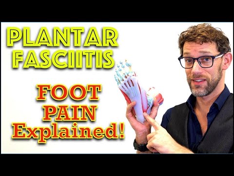 What Does Planters Fasciitis Look Like
