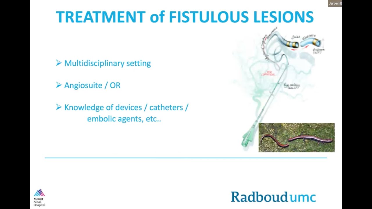 Treatment of Cranial Fistulous Lesions: What is important and why ...