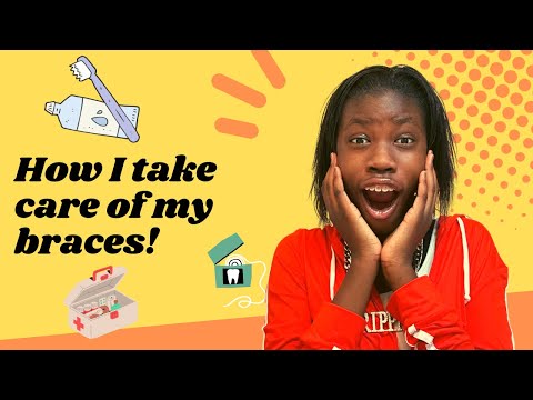 I GOT BRACES!  #dentist #braces #braceface  #viral #trending #explore