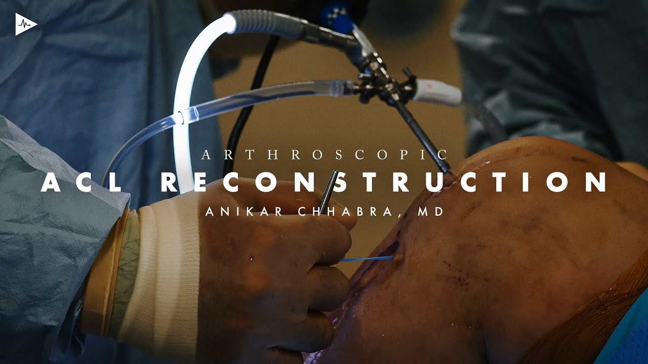 ACL Reconstruction | Preview - YouTube