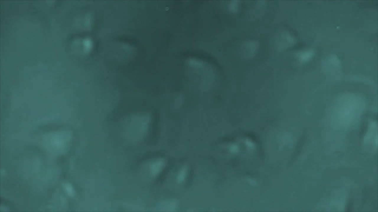 Spirochaete bacteria in motion - YouTube