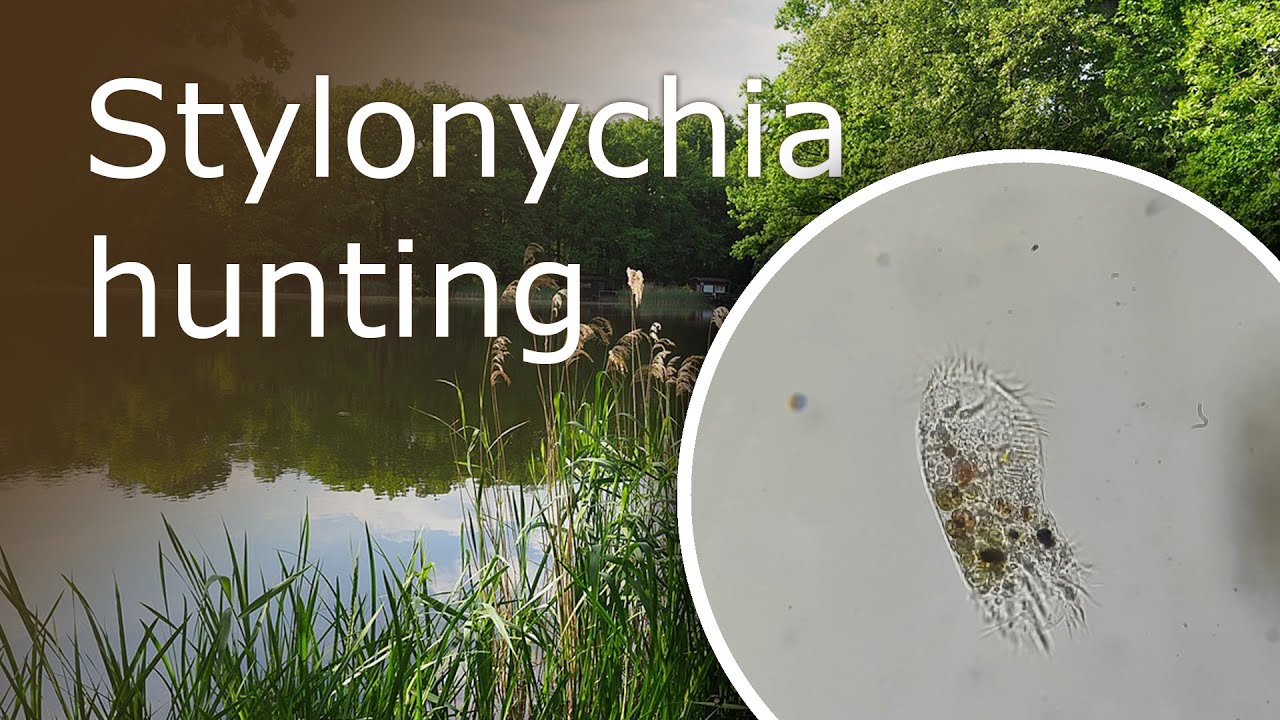 Stylonychia Under a Microscope: Hunting And Eating Other Protozoa - YouTube