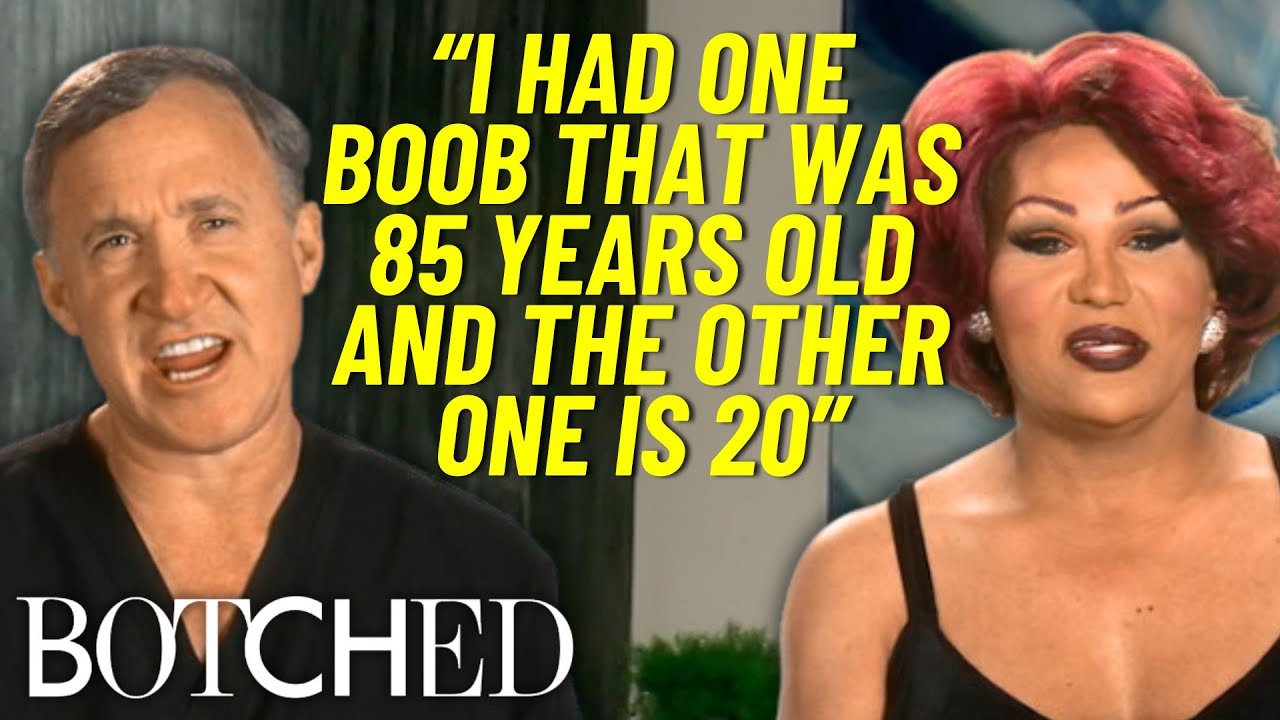 Dr. Dubrow Fixes Flame Monroe's Lopsided Breast Implants | Botched | E ...