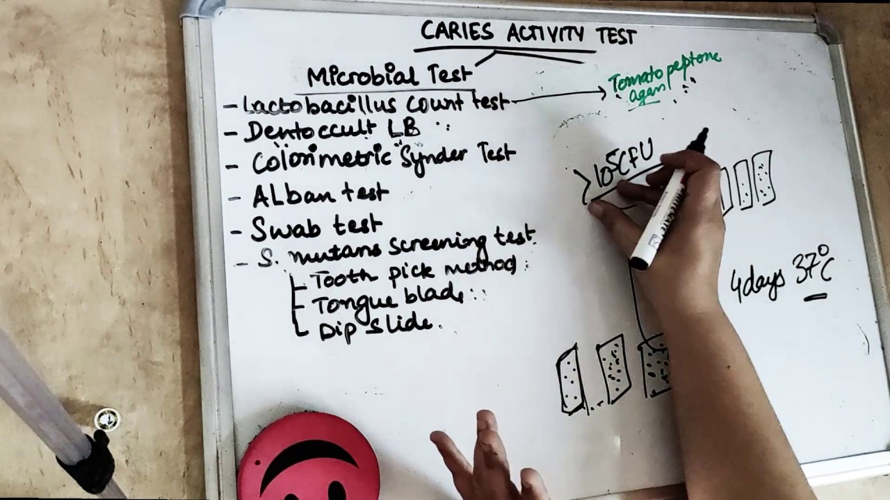 caries activity test lecture (part 1) - YouTube
