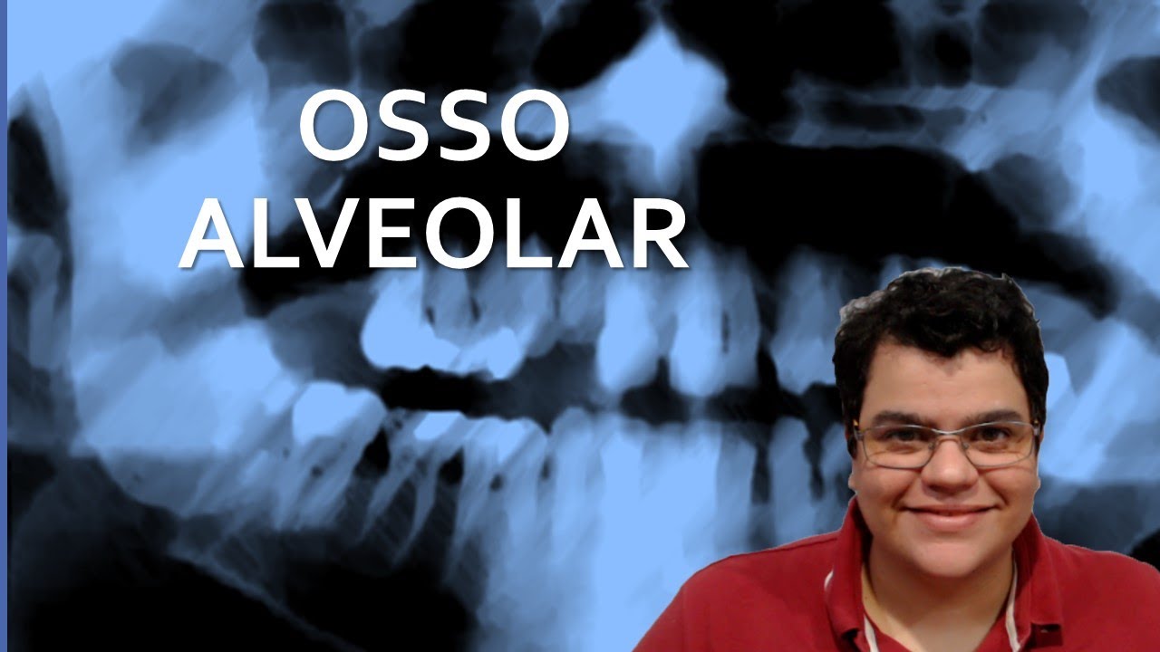 Caracteristicas do Osso Alveolar | Dra Bianca Rosa - YouTube