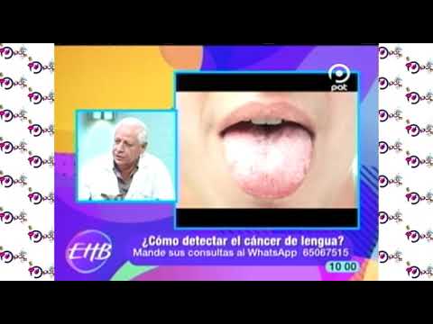 ¿Cómo detectar el cáncer de lengua? - YouTube