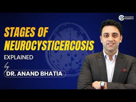Why Does Neurocysticercosis Cause Seizures? | Stages & CT Signs | Dr. Anand Bhatia
