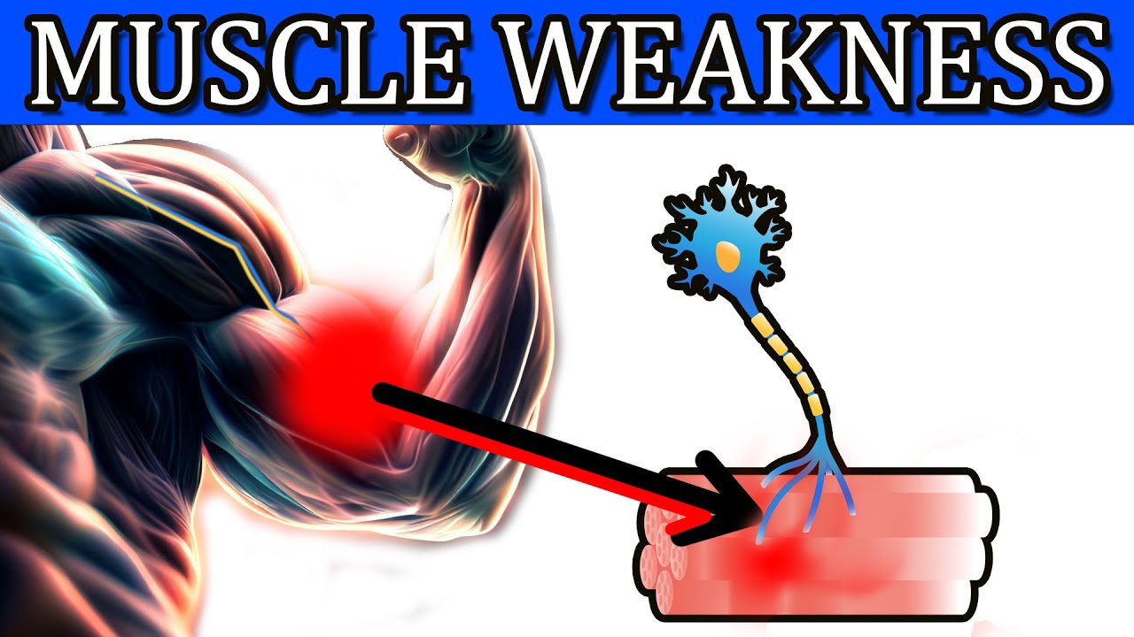 Muscle Weakness and Fatigue: Top 7 Causes - YouTube
