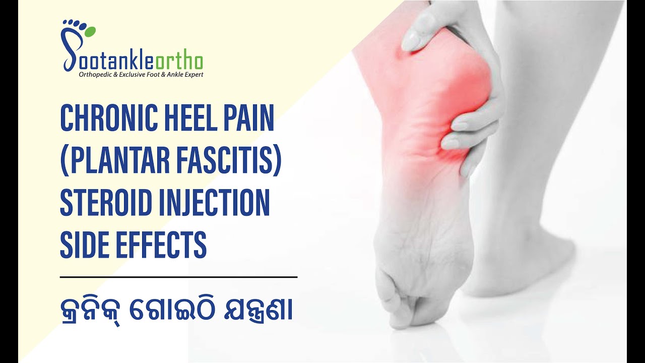 Chronic Heel Pain (Plantar Fascitis) Steroid Injection Side Effects ...