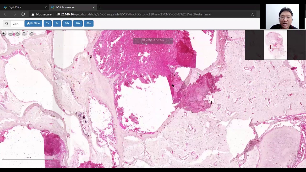 CNS lab (digital slides) - YouTube
