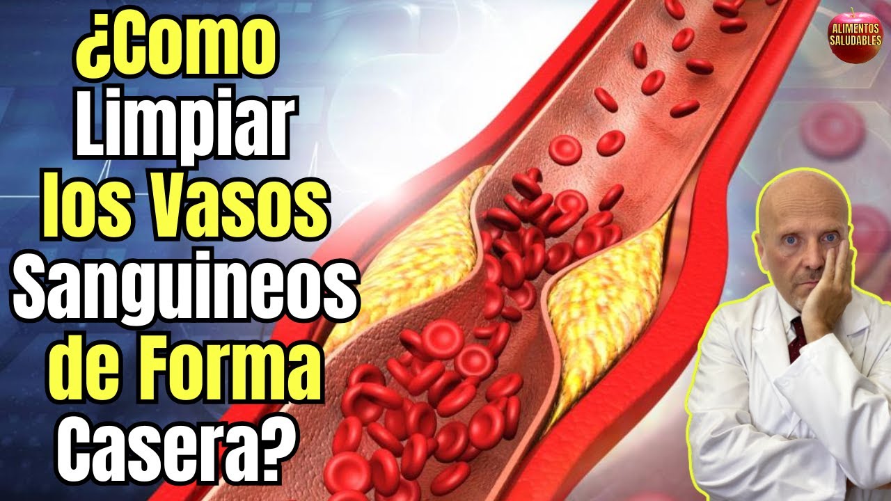 💝 ¿COMO LIMPIAR LOS VASOS SANGUINEOS DE FORMA CASERA? 💝 - YouTube