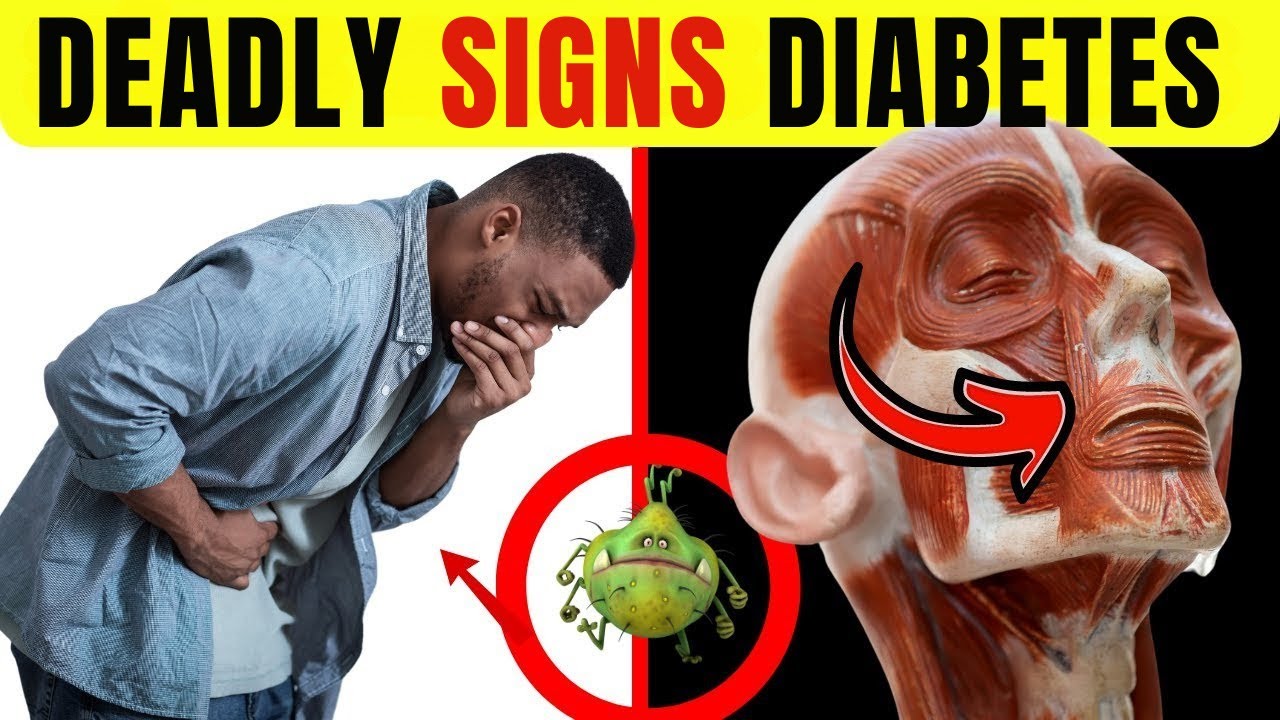 7 DEADLY SIGNS of DIABETES You Can't Ignore - YouTube