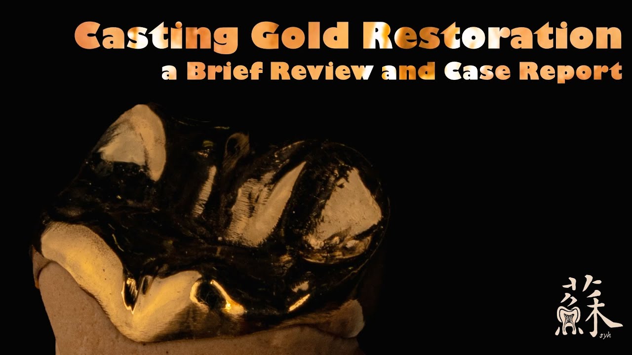 Casting Gold Restoration a Brief Review and Case Report - YouTube