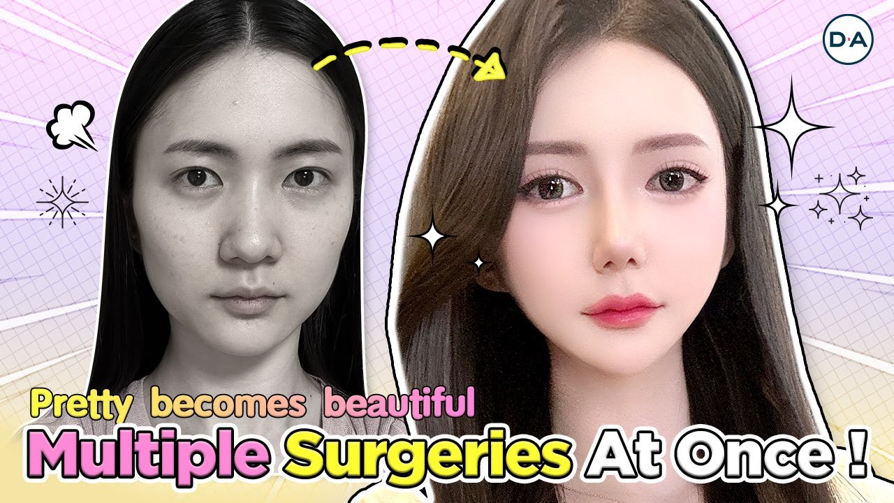 [Plastic Surgery Korea] Pretty Becomes Beautiful 💖 Multiple Surgeries ...
