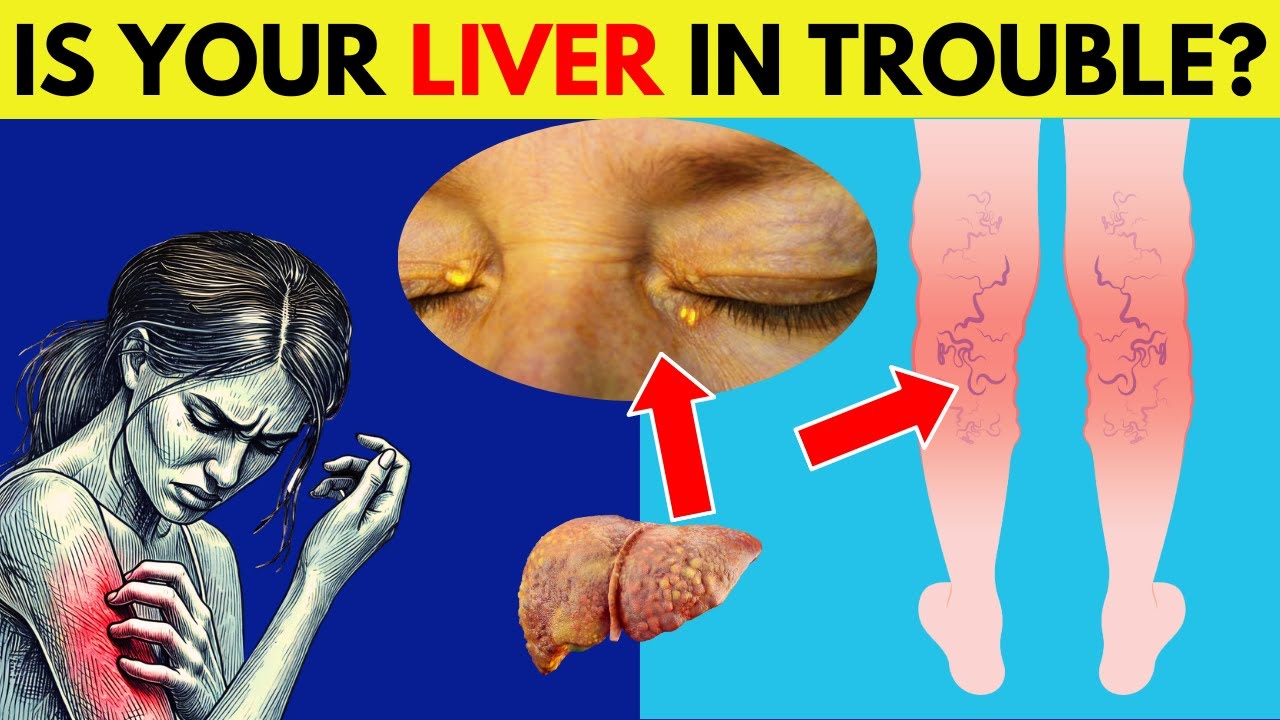 11 Strange Signs of LIVER DAMAGE - YouTube