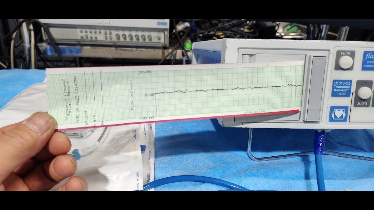 transonic systems Surgical Flowmeters HT313-cs - YouTube