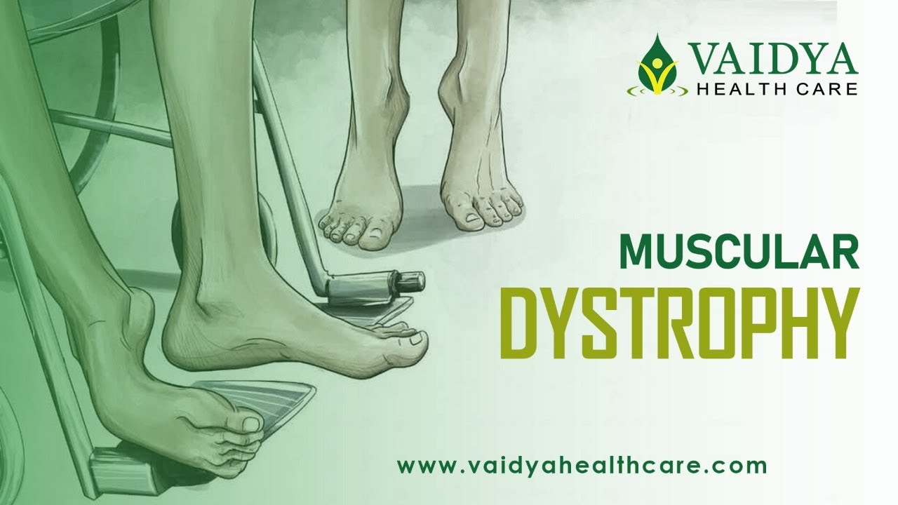 Best treatment for Muscular dystrophy @ Vaidya Healthcare | Dr. Anu ...