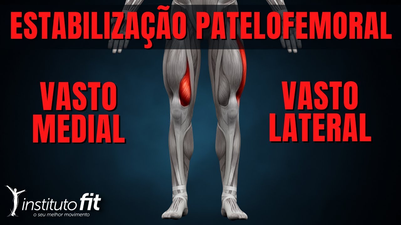 Relação do Vasto Medial X Vasto Lateral na estabilização da patela ...